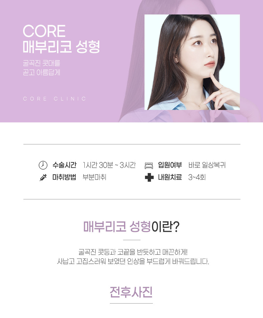 광명 코아의원 매부리코 성형